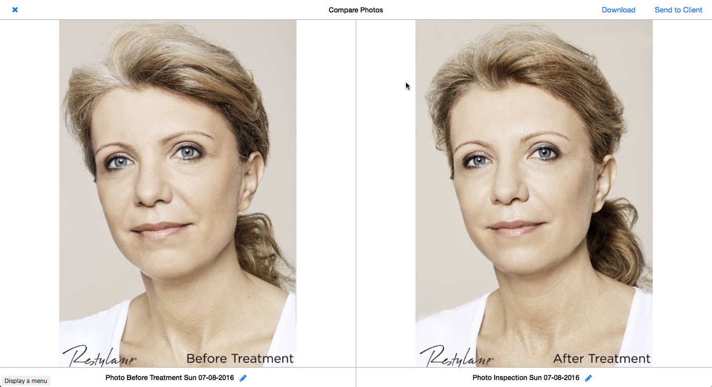 Photo comparison tool - Clinicminds